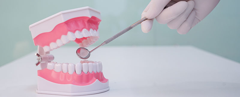 Prophylaxie dentaire Bayeux au cabinet dentaire - Dentiste Bayeux