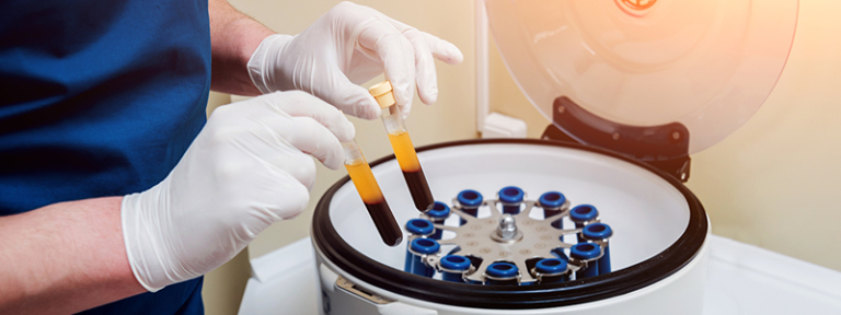 Prf : Platelet Riche Fibrin ou Fibrine riche en plaquettes - Dentiste ...